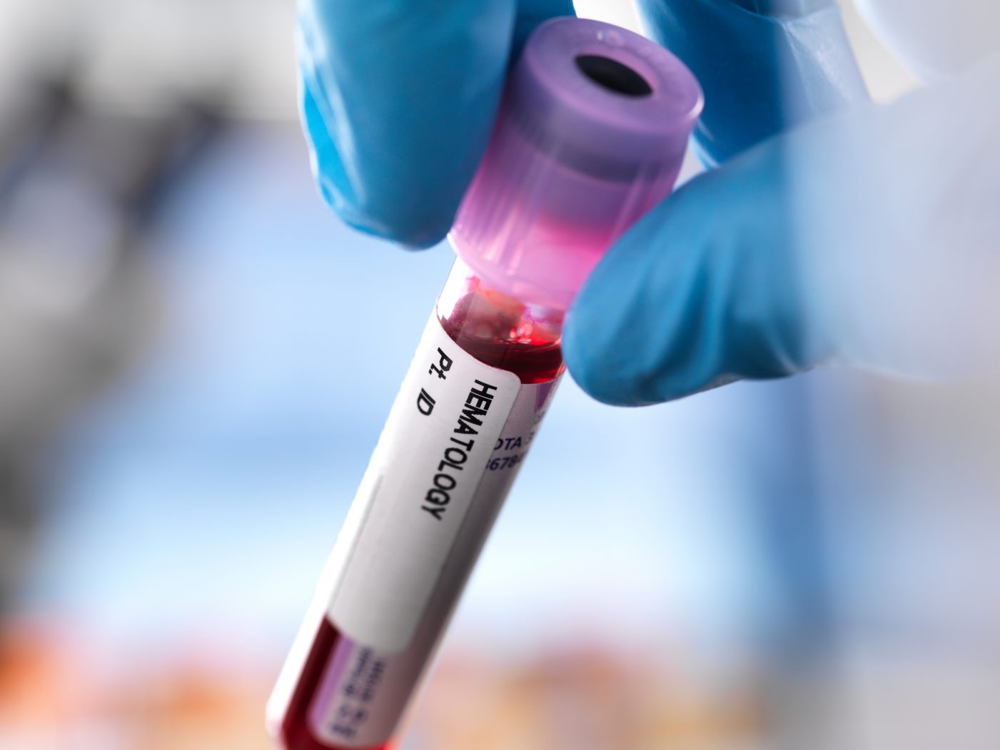 IVD Product Series - WEGO Medical