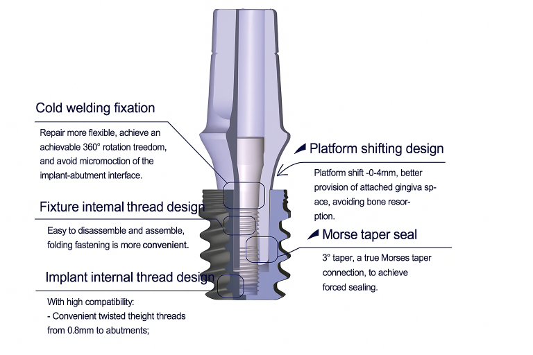 Innovative Solution For Narrow Ridges: WEGO Sedga Narrow Dental Implant ...