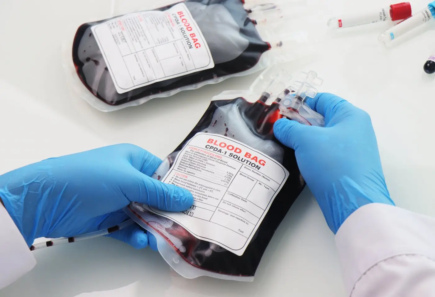 The Essential Role Of Blood Bag Labels For Safe Transfusion Practices ...