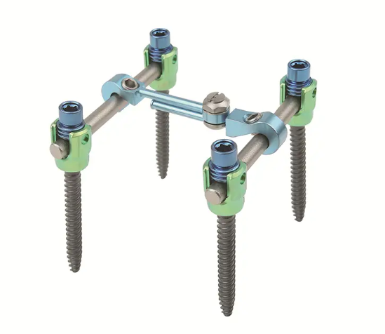 Types Of Orthopedic Implants: A Focus On Spinal Fixation Systems - WEGO ...