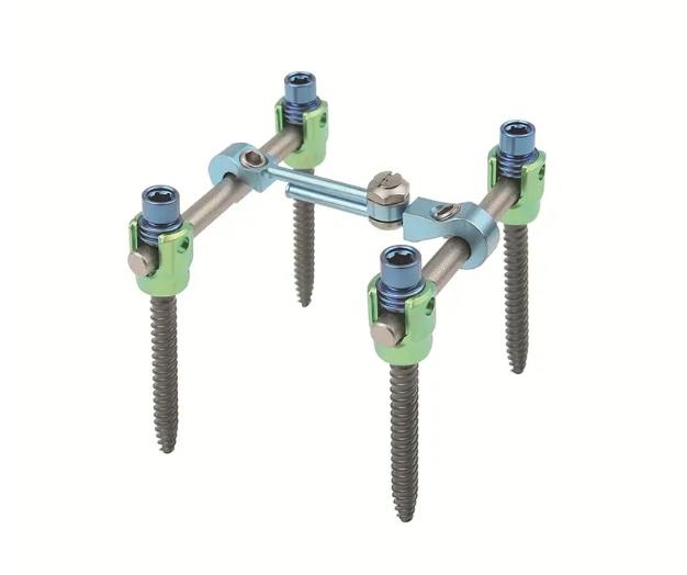 Factors Influencing The Duration Of Spinal Fixation Surgery - WEGO Medical